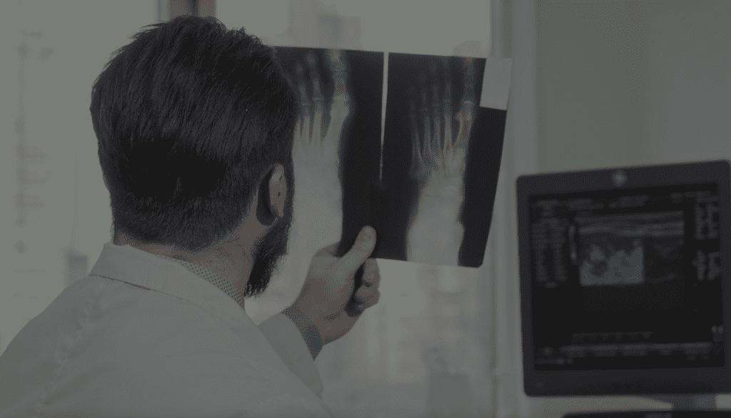 OSSIOfiber® Compression Screw Fixation for Intercuneiform Instability ...