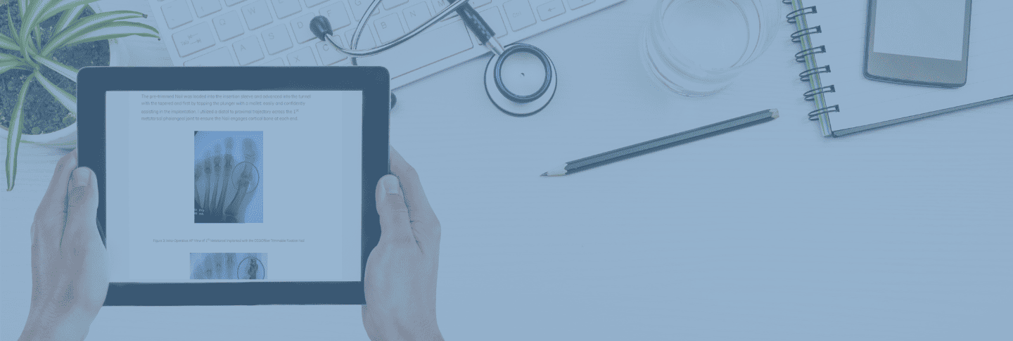 OSSIOfiber® Compression Screw Fixation for Intercuneiform Instability ...