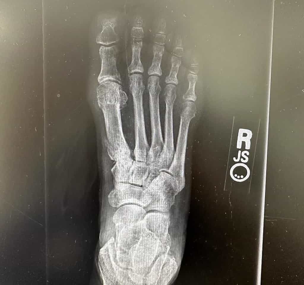 OSSIO – Naturally Transformative Bone Healing