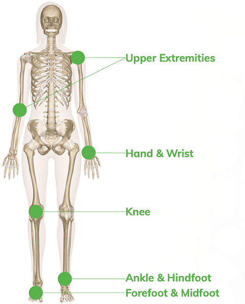 OSSIOfiber® Bio-Integrative Metal-Free Compression Screws