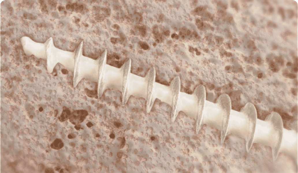 The Science Behind OSSIOfiber® Bone Regeneration Technology