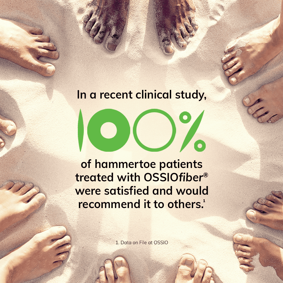 OSSIOfiber® Hammertoe Fixation System