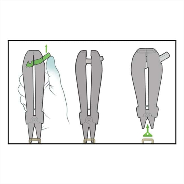 OSSIOfiber® Bio-Integrative Metal-Free Compression Staples