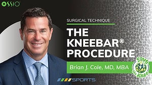 KneeBar® Procedure - OSSIO – Naturally Transformative Bone Healing